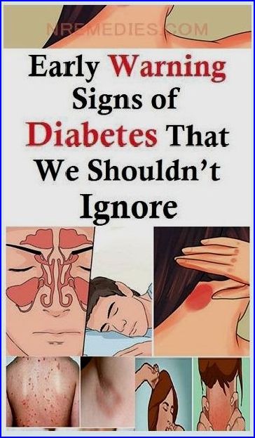 Early Warning Signs Of Diabetes That We Shouldn’t Ignore | HEALTHY TIPS